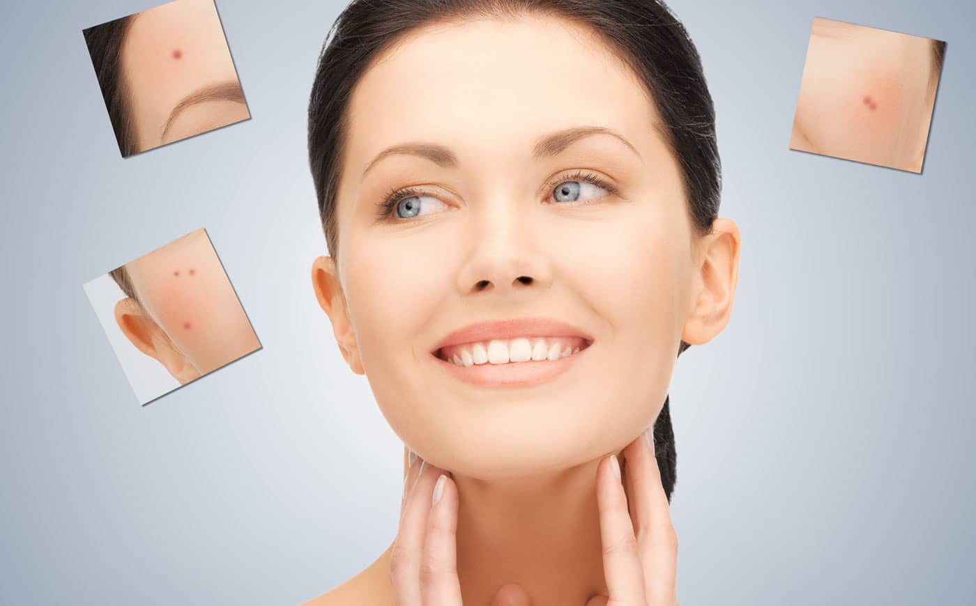 Tâches pigmentaires |Clinique Duquesne